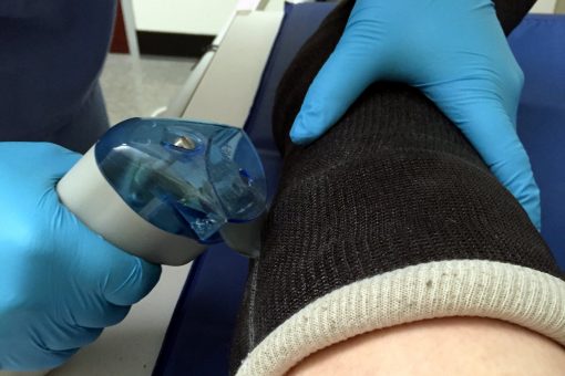 Cast removal: See how it's done, step-by-step - Lilyvolt